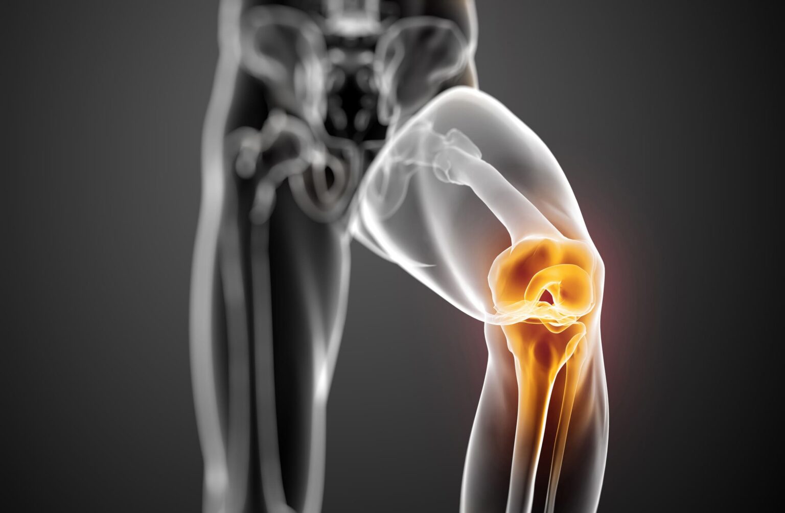 Cuáles son las principales lesiones de rodilla - Goniomedic